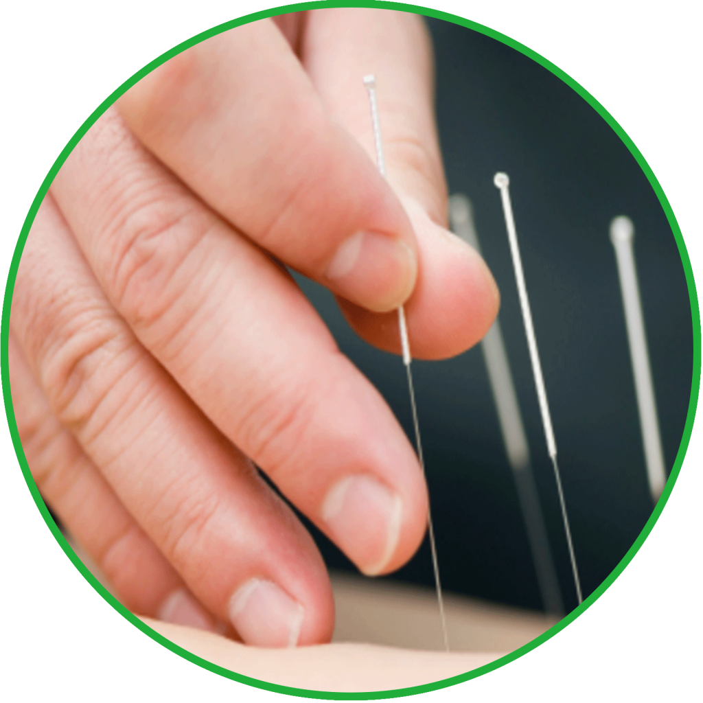 Traditional Chinese Acupuncture | The Traditional Way Clinic